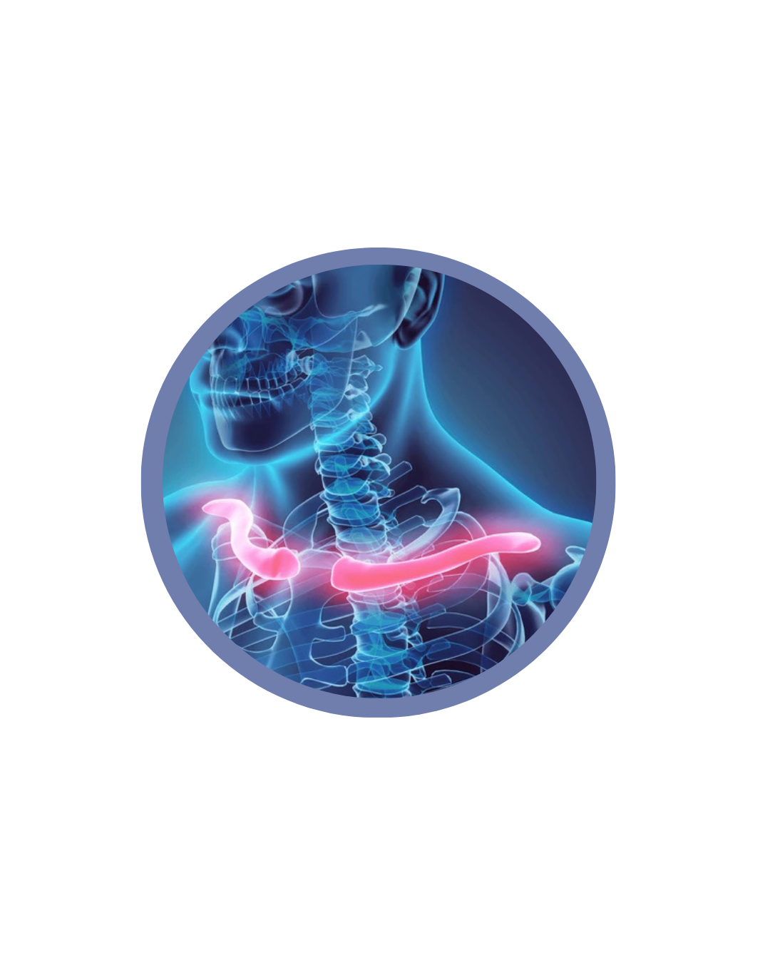 Clavicle System - Mechfix Implants